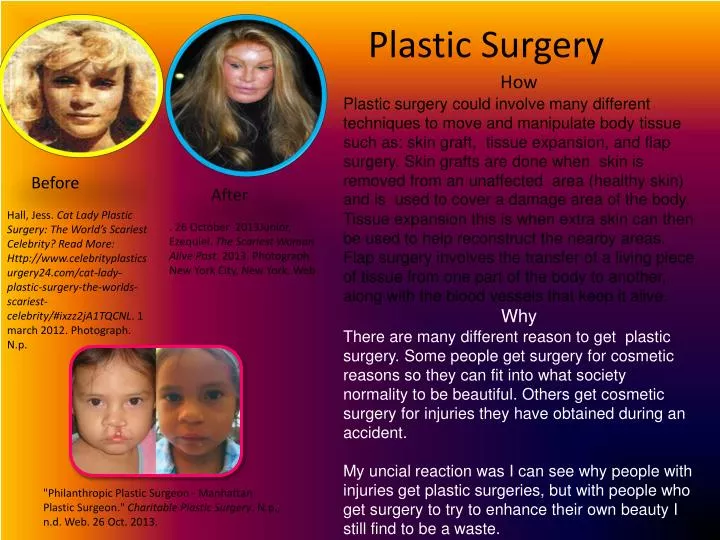 PPT - Plastic Surgery PowerPoint Presentation, free download - ID:2192428