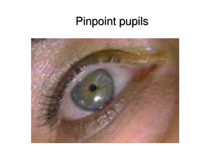 PPT - Management of unconscious patient PowerPoint Presentation - ID ...