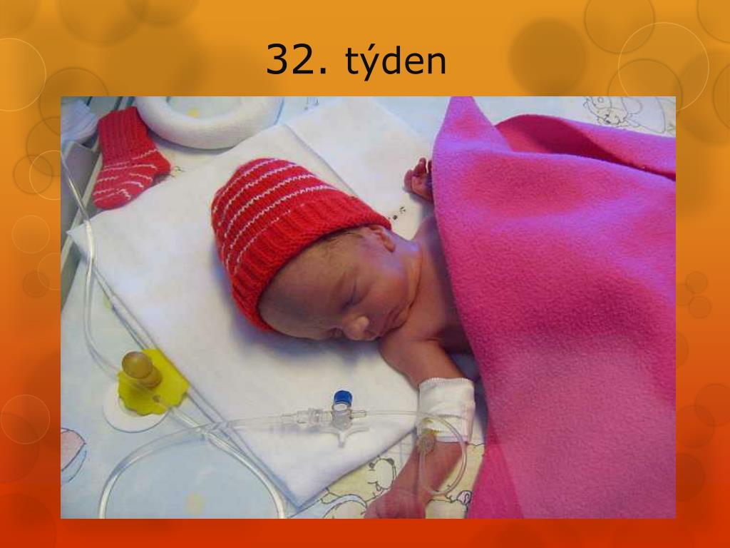 PPT - Prenatální a perinatální období PowerPoint Presentation, free ...