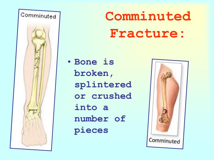 PPT - Muscles and Bones PowerPoint Presentation - ID:2202977