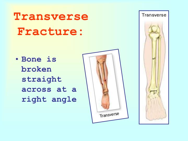 PPT - Muscles and Bones PowerPoint Presentation - ID:2202977