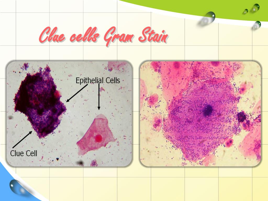 PPT - Genital Culture PowerPoint Presentation, free download - ID:2203483