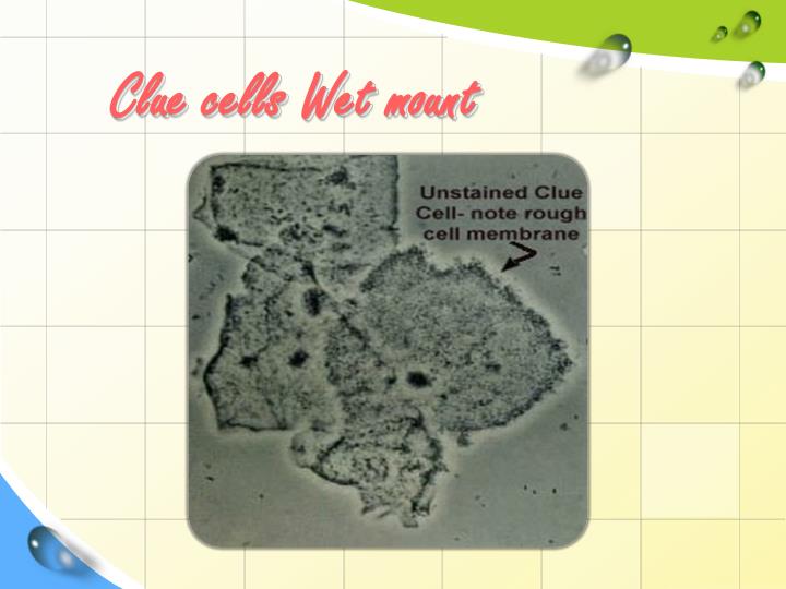 PPT - Genital Culture PowerPoint Presentation - ID:2203483