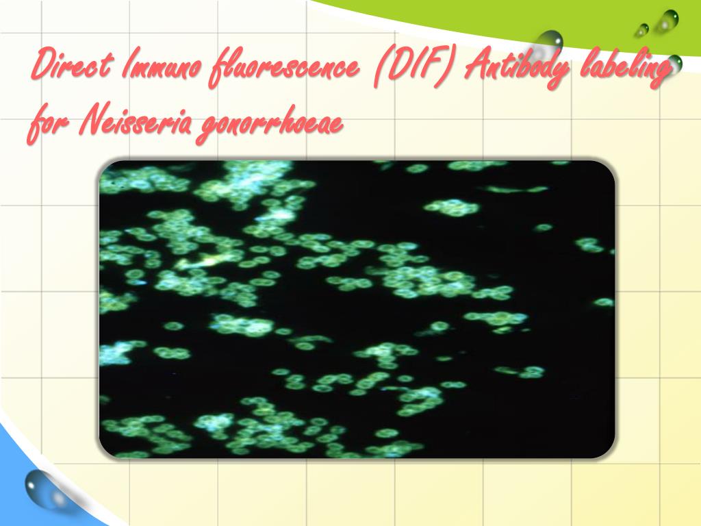 PPT - Genital Culture PowerPoint Presentation, free download - ID:2203483