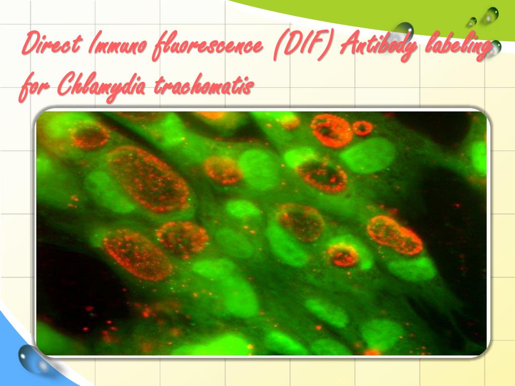 PPT - Genital Culture PowerPoint Presentation, free download - ID:2203483