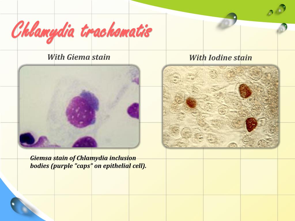 PPT - Genital Culture PowerPoint Presentation, free download - ID:2203483