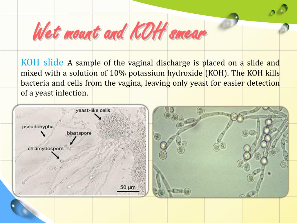 PPT - Genital Culture PowerPoint Presentation, free download - ID:2203483
