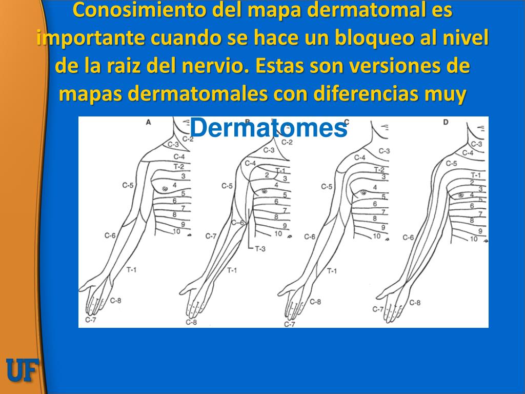 PPT - Anesthesiology Regional Anesthesia Barys Ihnasenka , and William ...