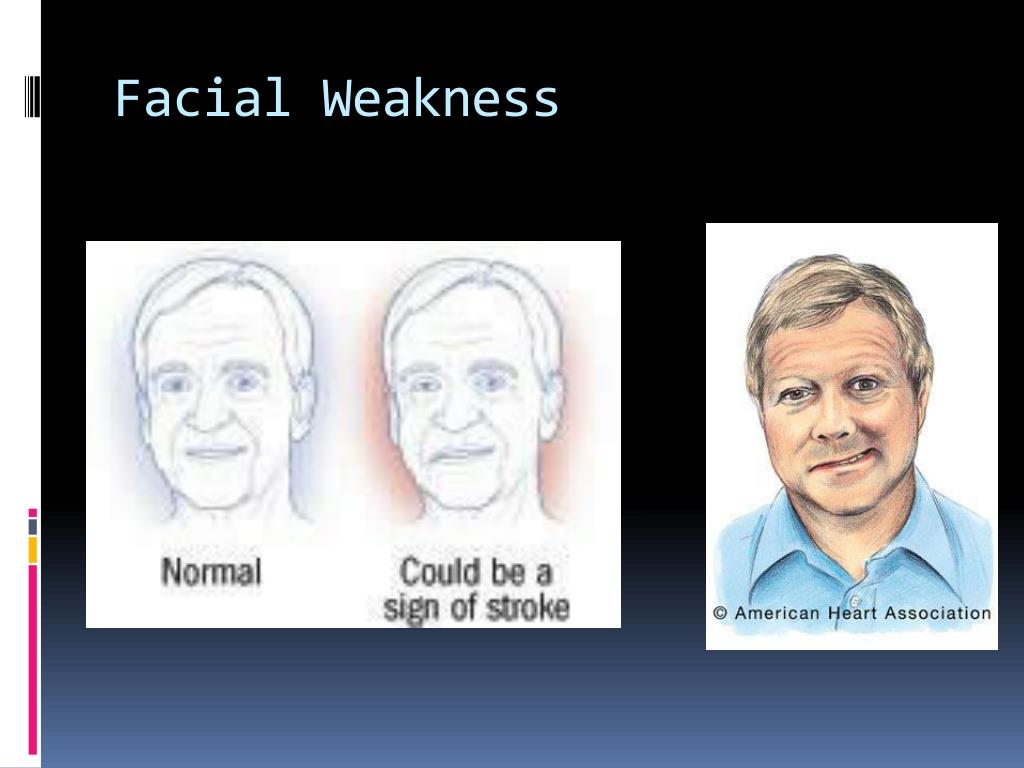 PPT - Dr Aaron de Souza MD, DM, DNB, MNAMS Consultant Neurologist ...