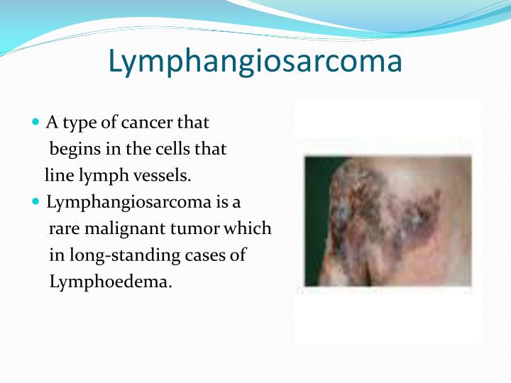 PPT - LYMPHATIC SYSTEM PowerPoint Presentation - ID:2206087