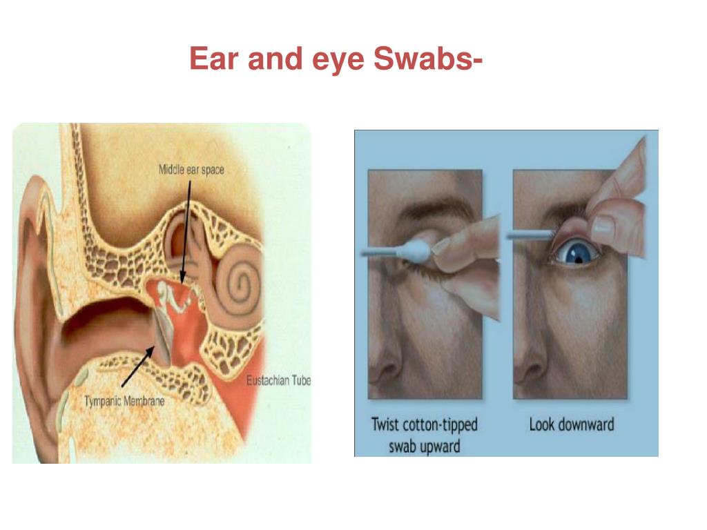 PPT - MEANS OF viral infection DIAGNOSIS PowerPoint Presentation, free ...