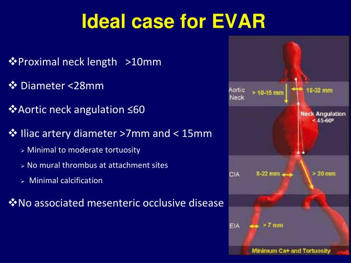 PPT - Endovascular aneurysm repair ( EVAR) PowerPoint Presentation - ID ...