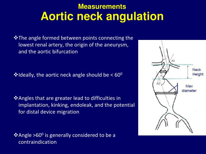 PPT - Endovascular aneurysm repair ( EVAR) PowerPoint Presentation - ID ...