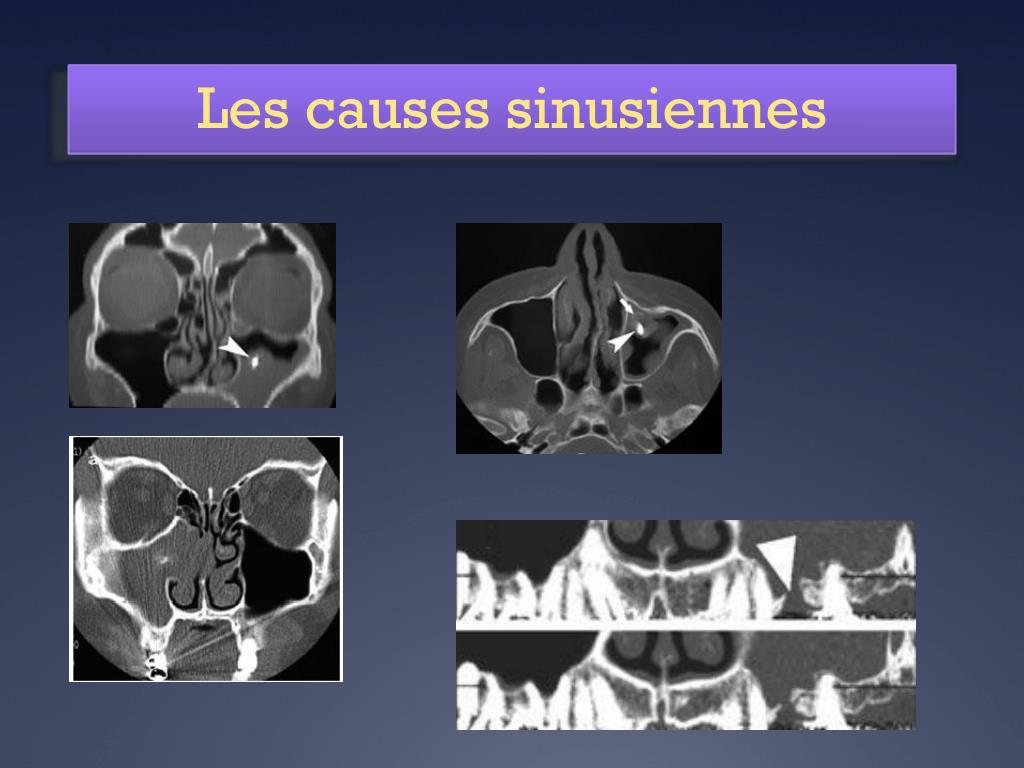 PPT - Dr Sabine Bailleul Pôle de consultations Tassigny , Angers ...