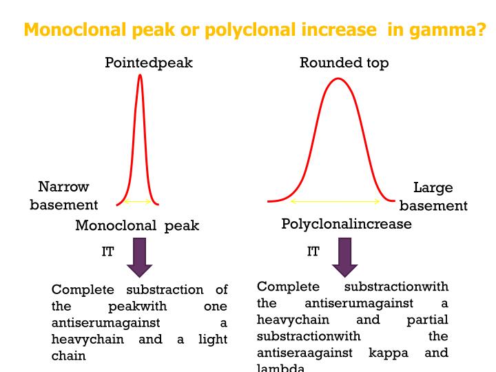 PPT - Serum Protein Electrophoresis with Immunofixation PowerPoint ...