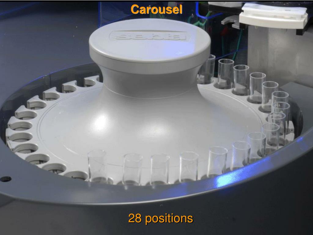 PPT - Serum Protein Electrophoresis with Immunofixation PowerPoint ...