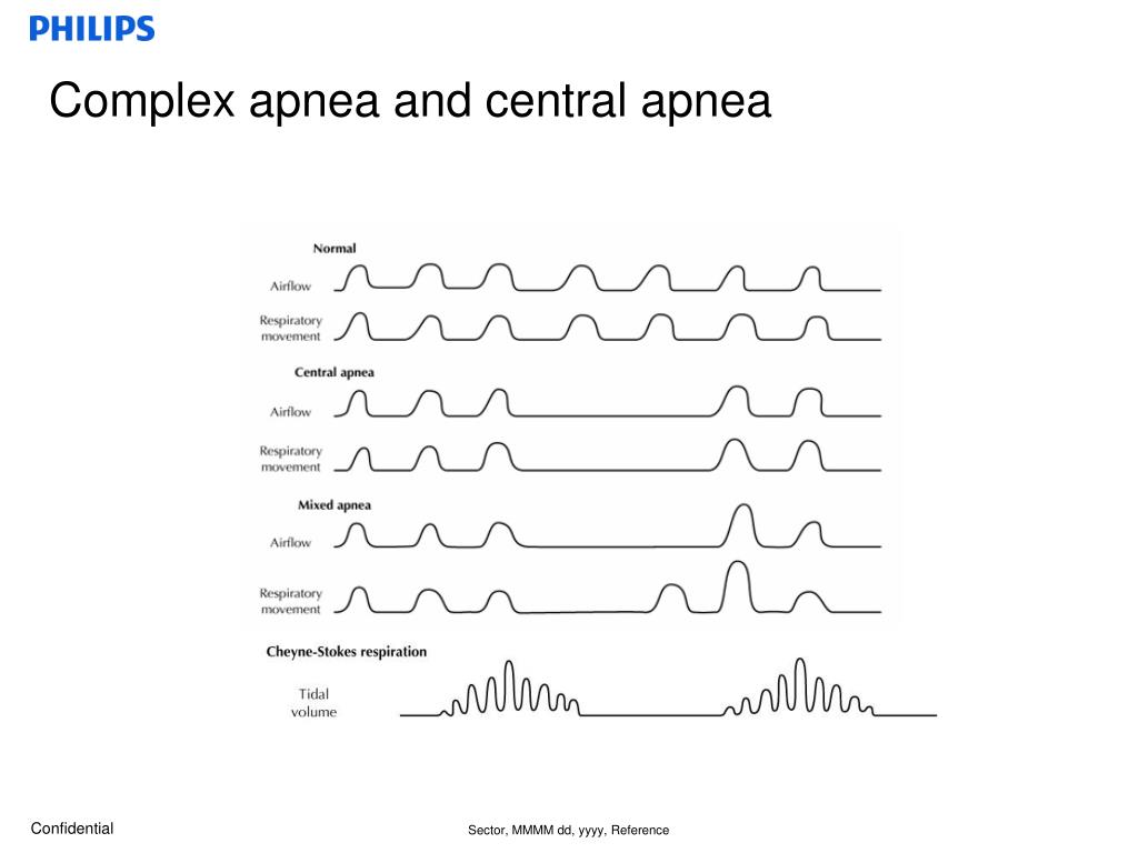 PPT - breathing , respiratory diseases, and mechanical ventilation ...