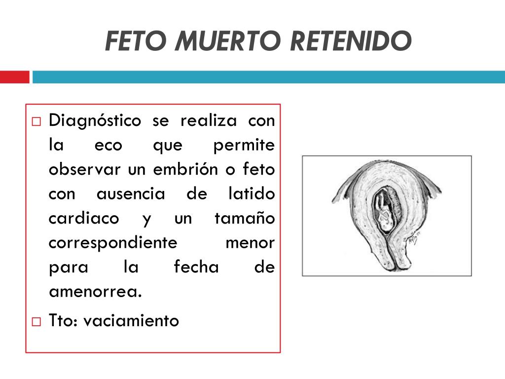 PPT - SANGRADO EN EL PRIMER TRIMESTRE DE EMBARAZO PowerPoint ...