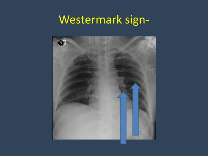 PPT - Venous air embolism (VAE) PowerPoint Presentation - ID:2209829