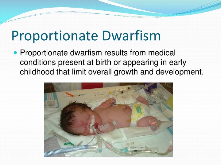 PPT - Dwarfism PowerPoint Presentation - ID:2211221
