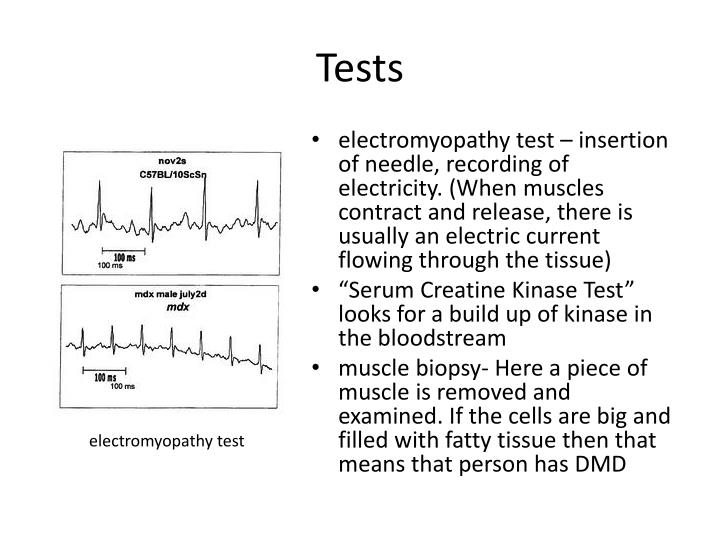 PPT - Duchenne Muscular Dystrophy PowerPoint Presentation - ID:2211783