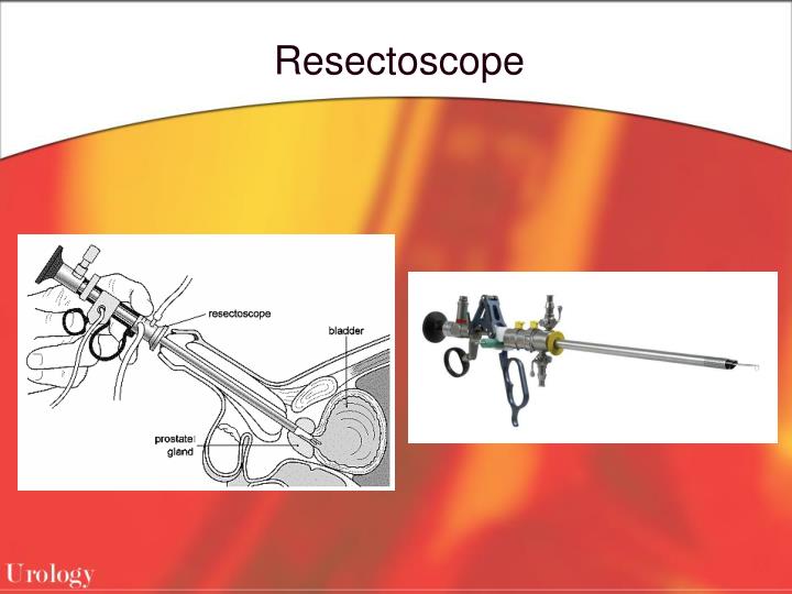 PPT - Lower Urinary Tract Symptoms (LUTS) and Management of Benign ...
