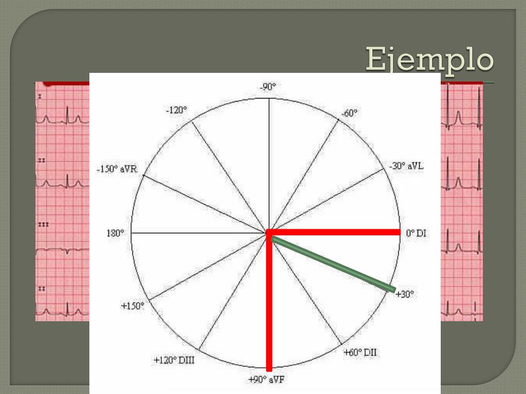 PPT - Curso de Electrocardiograma PowerPoint Presentation, free ...