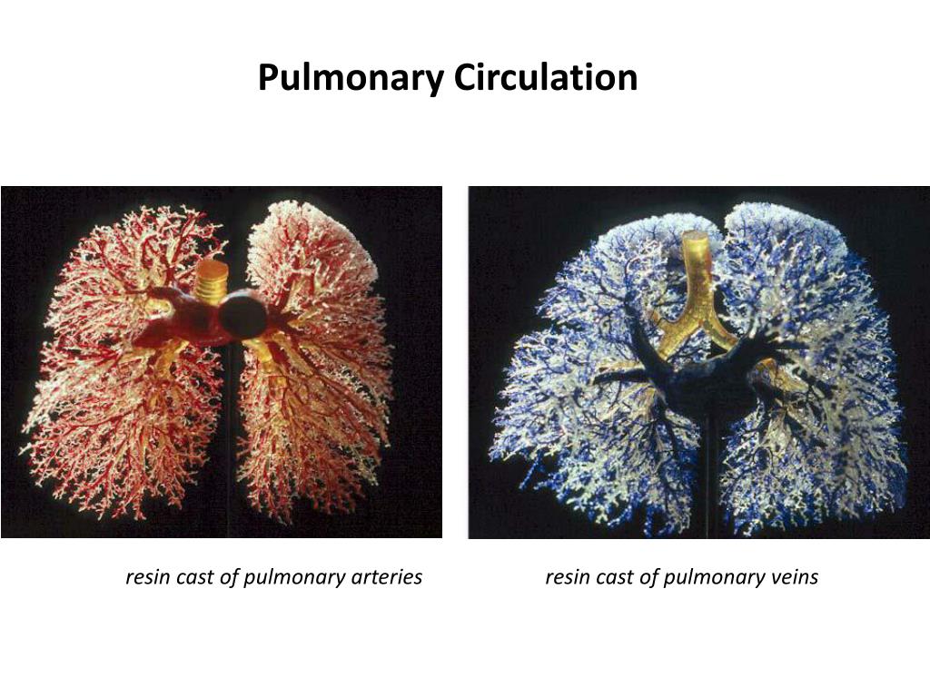 PPT - resin cast of pulmonary arteries resin cast of pulmonary veins ...