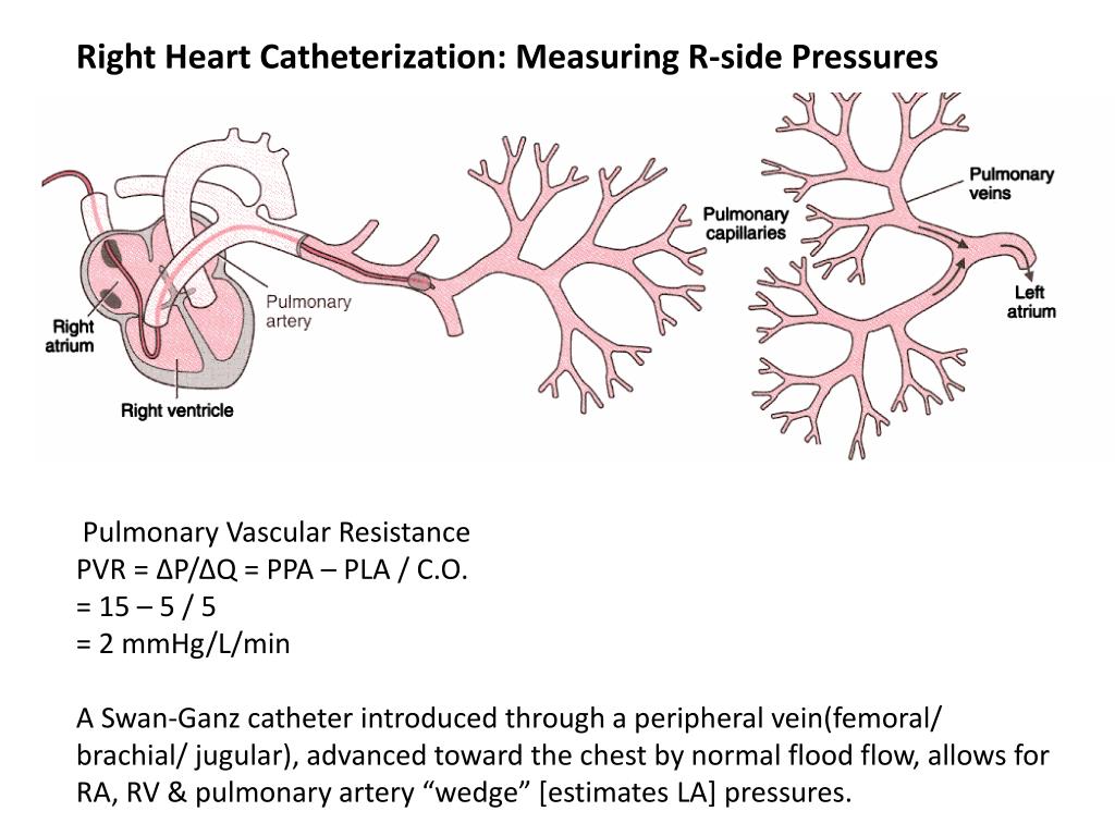 PPT - resin cast of pulmonary arteries resin cast of pulmonary veins ...