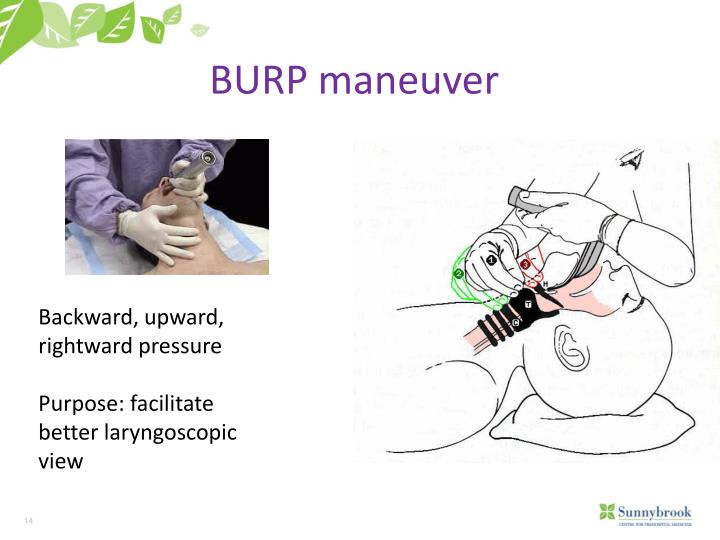 PPT - THE SPECTRUM OF CONTINUOUS AIRWAY ASSESSEMENT AND MANAGEMENT ...