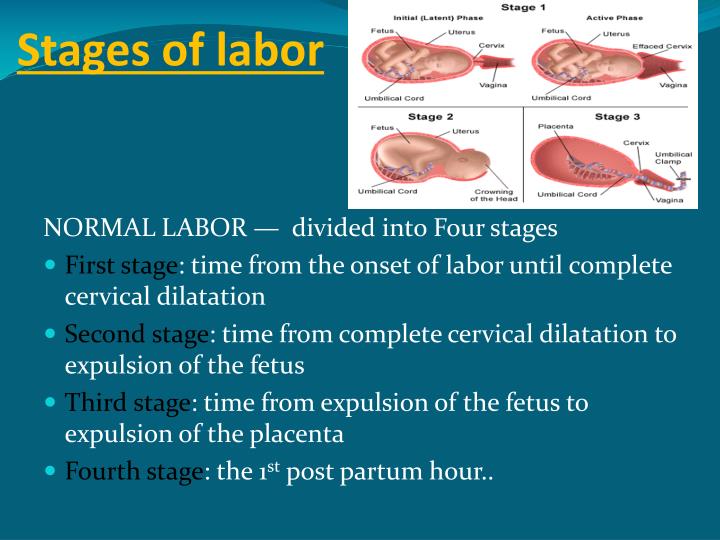 Ppt First Stage Of Labor Powerpoint Presentation Id 2221869