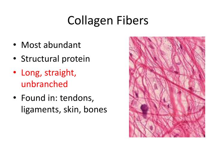 PPT - Connective Tissue PowerPoint Presentation - ID:2223312