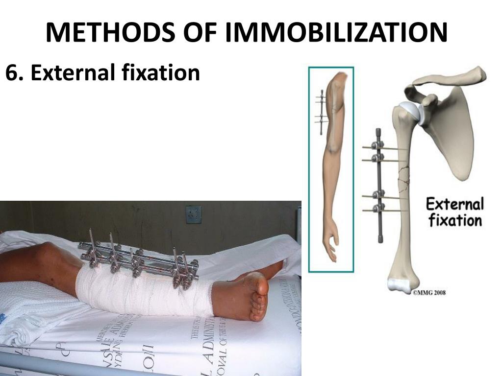 PPT - Dr.AbdulWAHID M Salih Ph.D. Surgery PowerPoint Presentation, free ...
