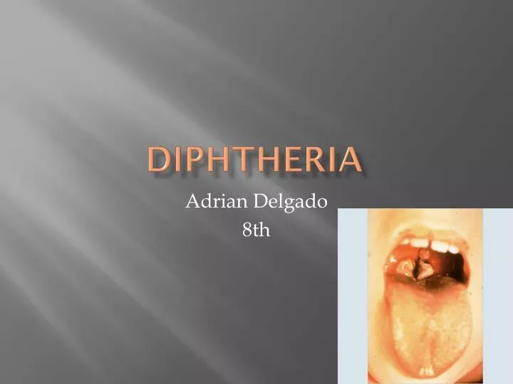 PPT - DIPHTHERIA PowerPoint Presentation, free download - ID:2224144