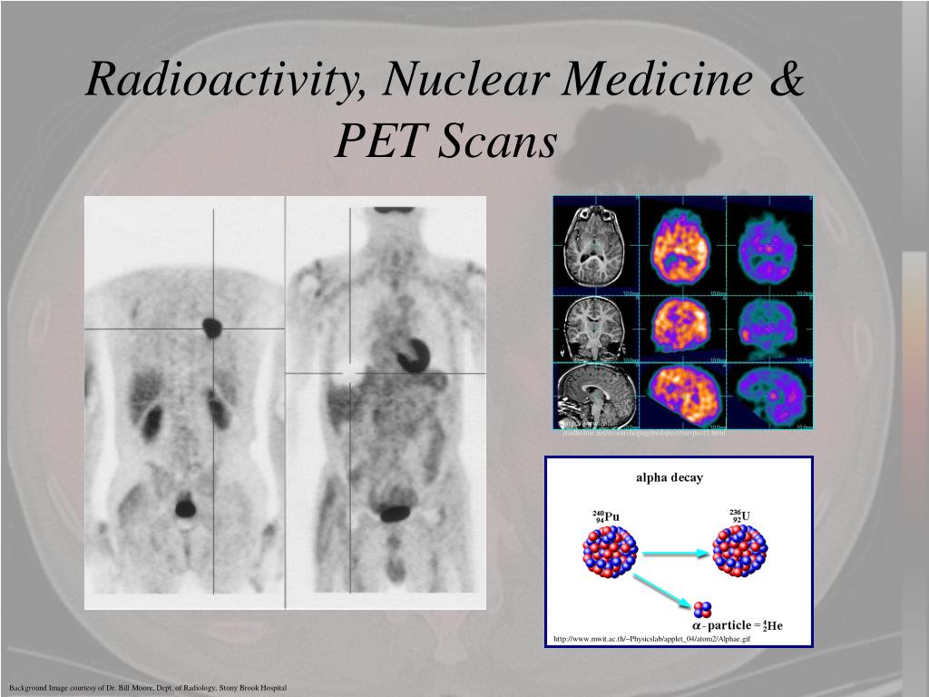 PPT - Radioactivity, Nuclear Medicine & PET Scans PowerPoint ...