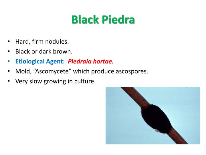PPT - Fungi PowerPoint Presentation - ID:2225054
