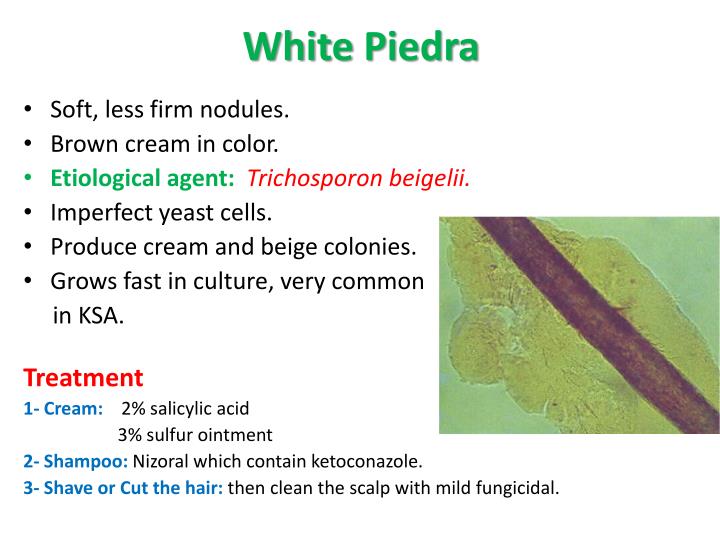 PPT - Fungi PowerPoint Presentation - ID:2225054