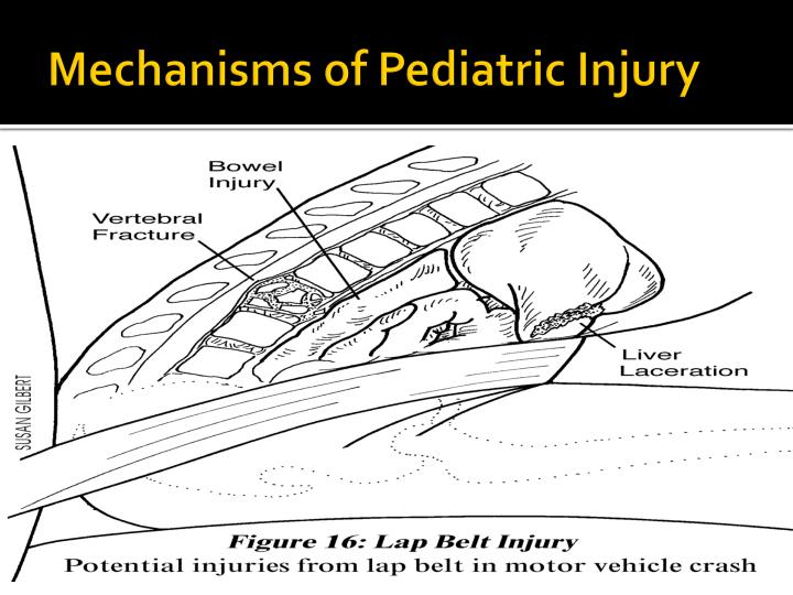 Ppt Approach To Common Pediatric Surgical Problems Powerpoint