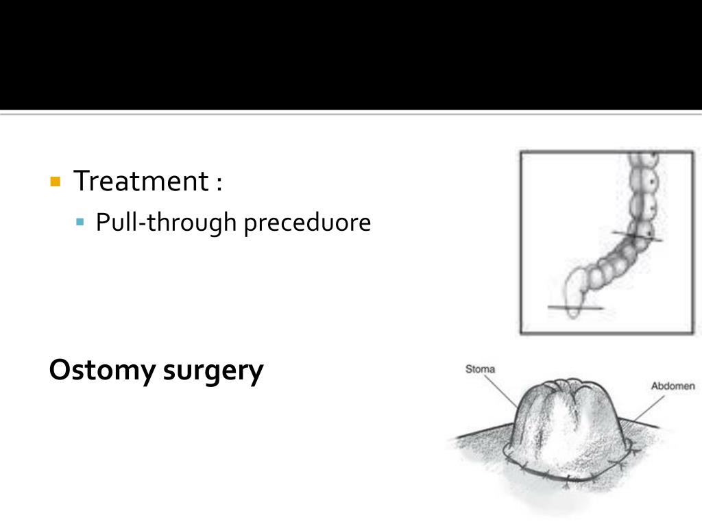 Ppt Approach To Common Pediatric Surgical Problems Powerpoint
