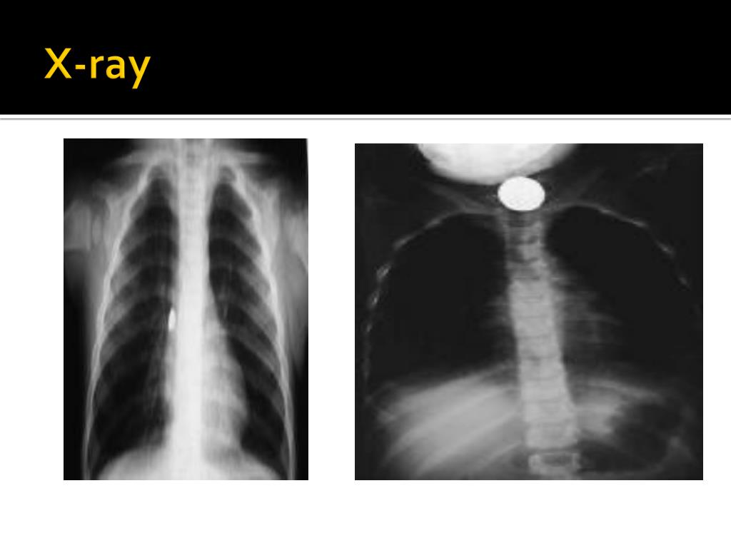 Ppt Approach To Common Pediatric Surgical Problems Powerpoint