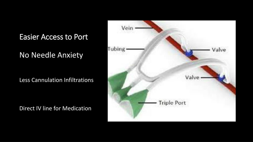 PPT - Hemova Dialysis Port PowerPoint Presentation, free download - ID ...