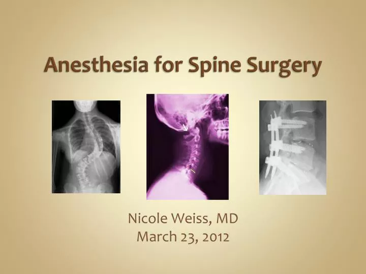 PPT - Anesthesia for Spine Surgery PowerPoint Presentation, free ...