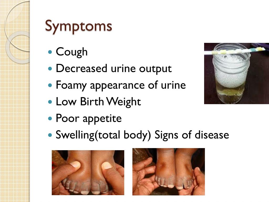 PPT - Nutrition Implications of Congenital Nephrotic Syndrome ...