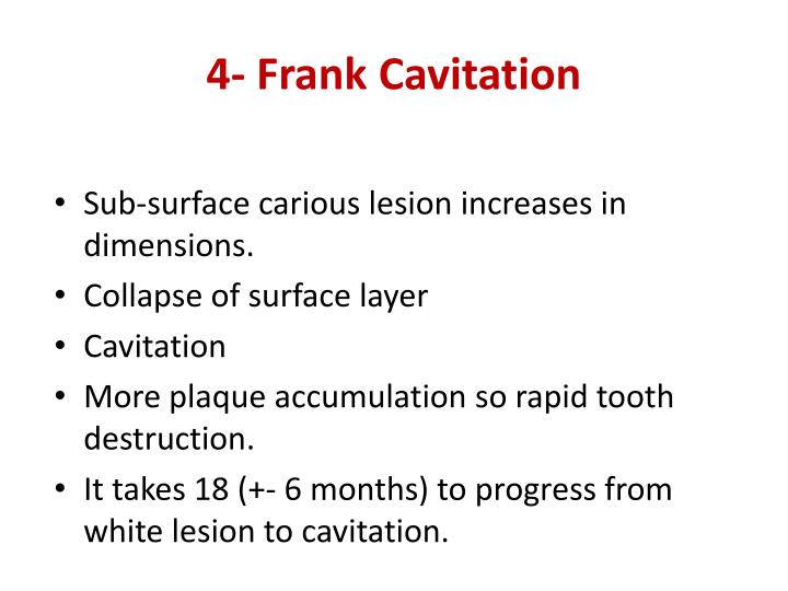 PPT - Etiology of Dental Caries PowerPoint Presentation - ID:2232181