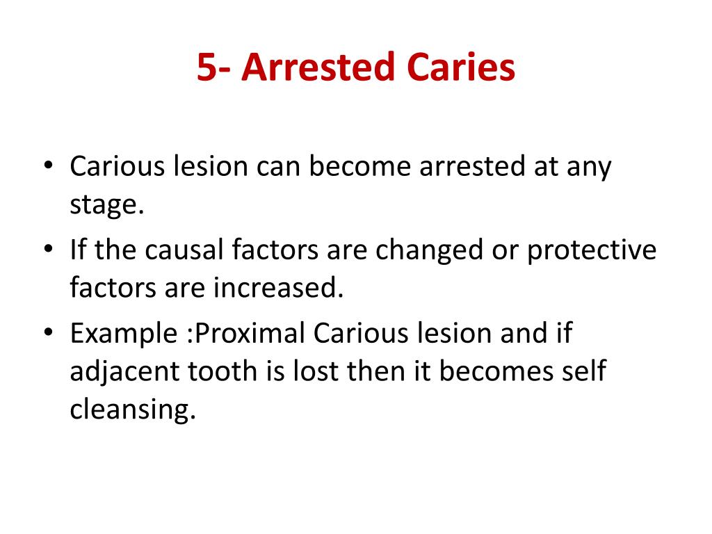 PPT - Etiology of Dental Caries PowerPoint Presentation, free download ...