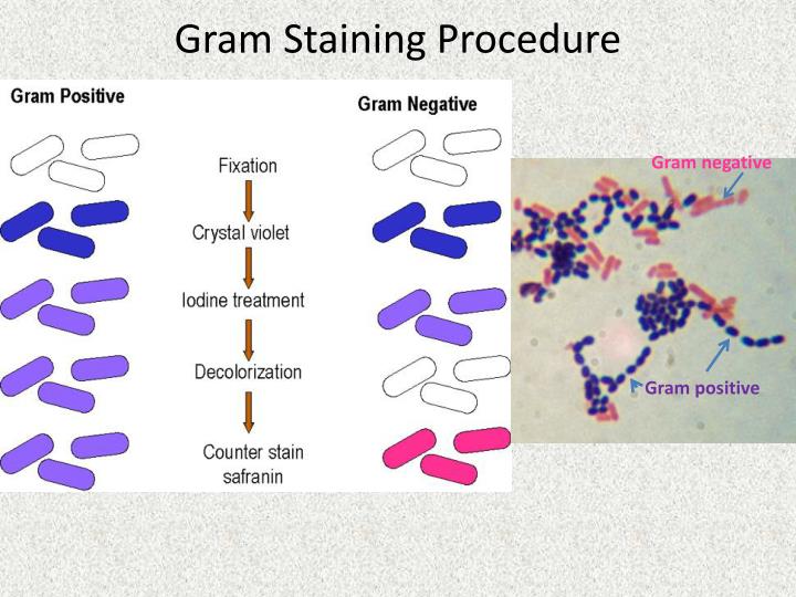PPT - Chapter 27: Prokaryotes PowerPoint Presentation - ID:2234899