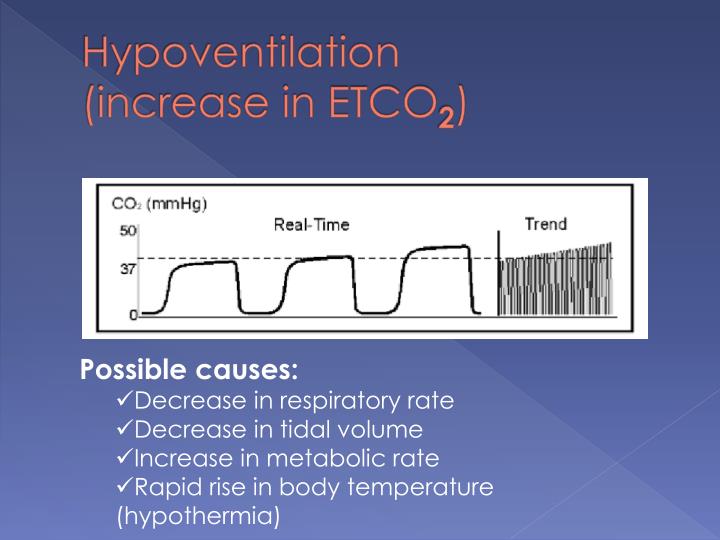 PPT - CAPNOGRAPHY PowerPoint Presentation - ID:2237765