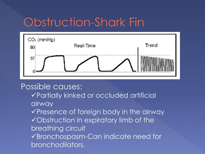 PPT - CAPNOGRAPHY PowerPoint Presentation - ID:2237765