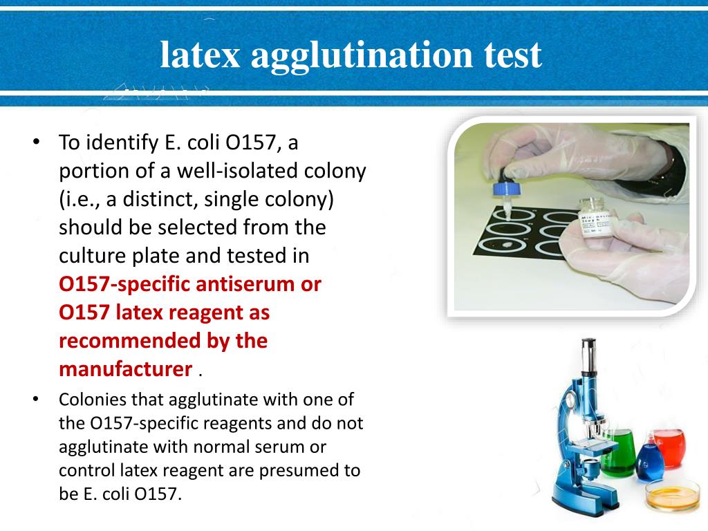 PPT - University of Gaza Faculty of Health Science Medical laboratory ...