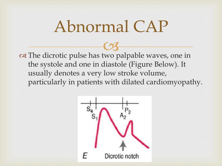 PPT - Jugular venous pressure and carotid arterial pressure PowerPoint ...